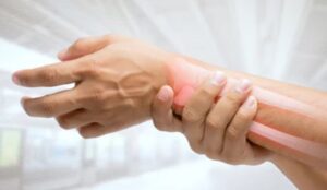 Distal RadioUlnar Joint & TFCC Injuries – Hand and Nerve Surgeon