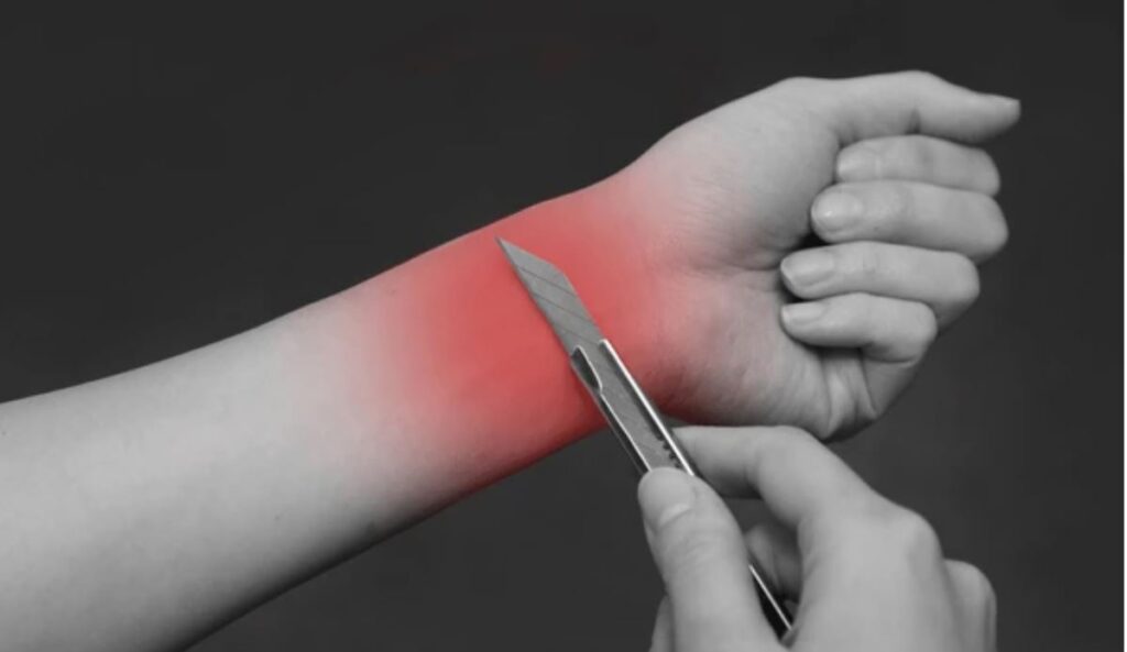 Spaghetti Wrist – Hand and Nerve Surgeon